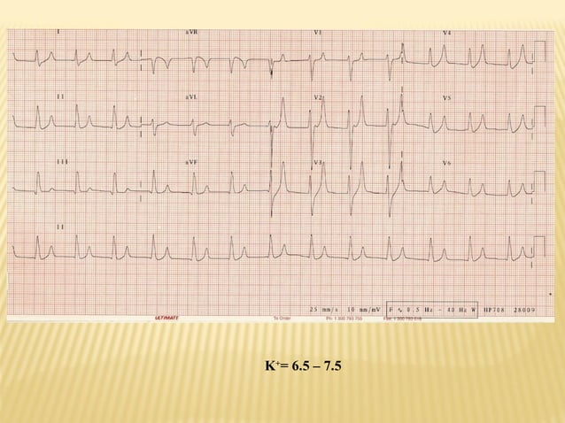 hypertension End Organ Damage with hemorhage | PPT