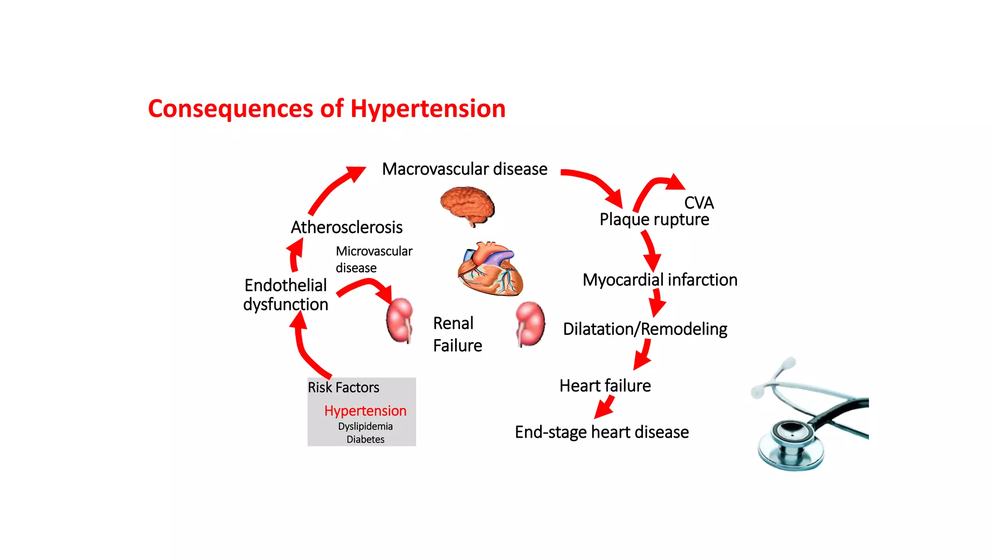Hypertension guidelines comparison.pptx