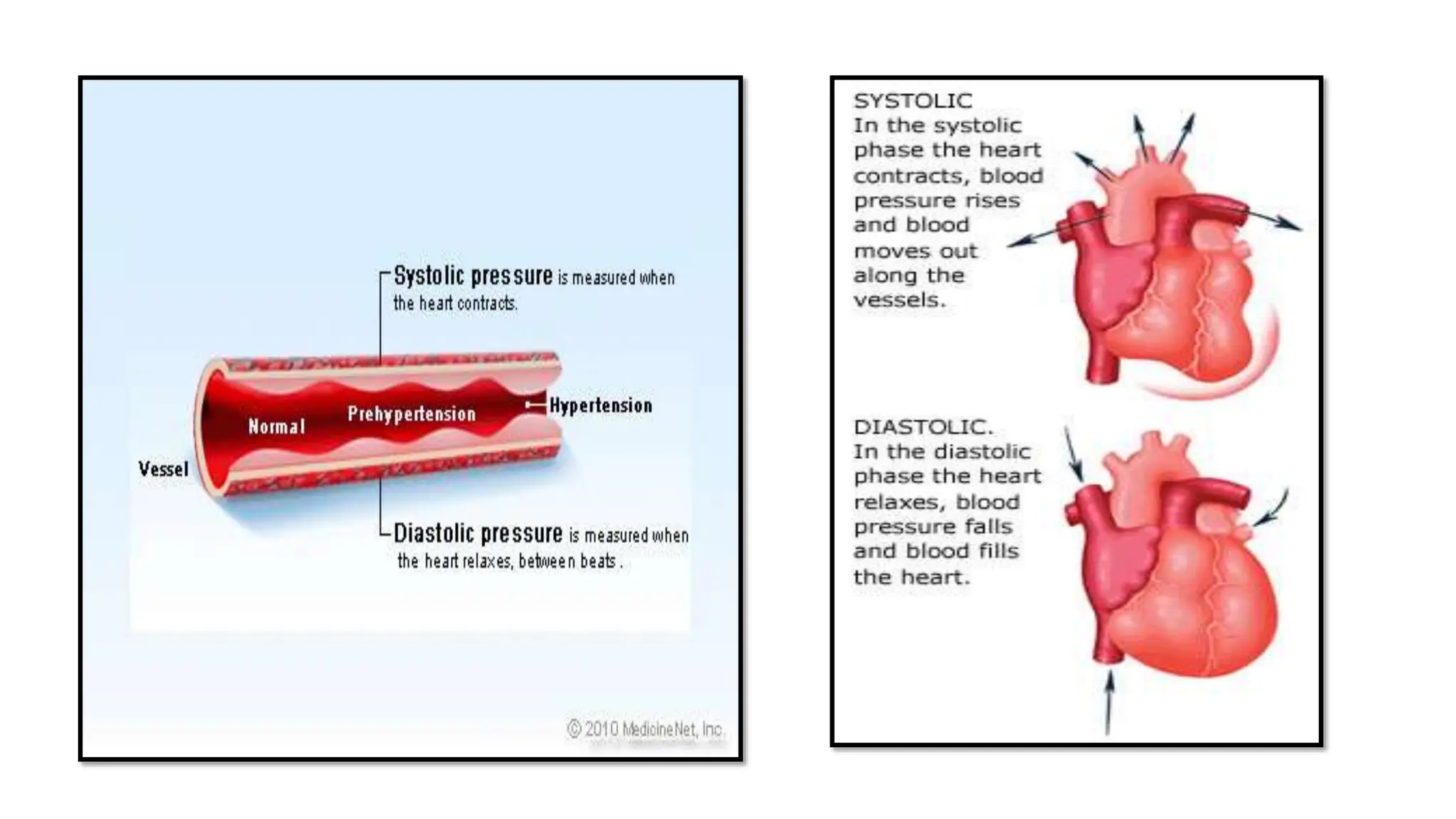 Hypertension Pathology.pptx