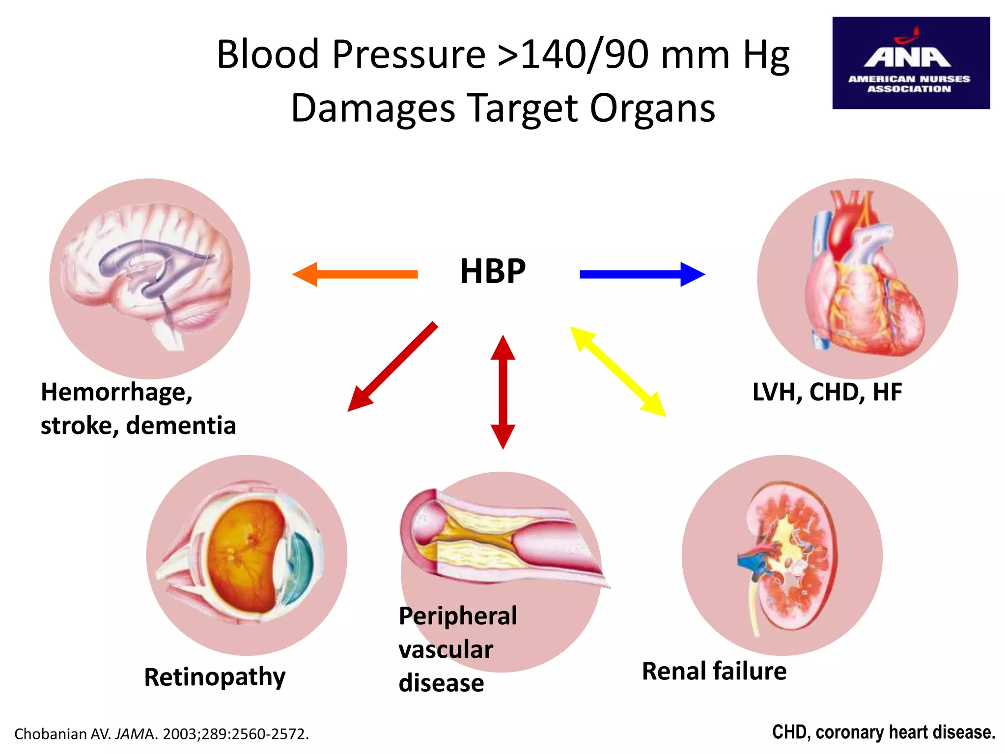 Hypertension power point for module | PPTX