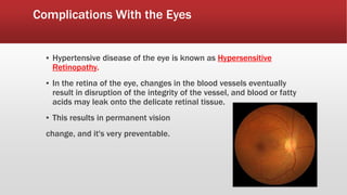 Hypertension And it's Management | PPTX | Heart and Cardiovascular ...