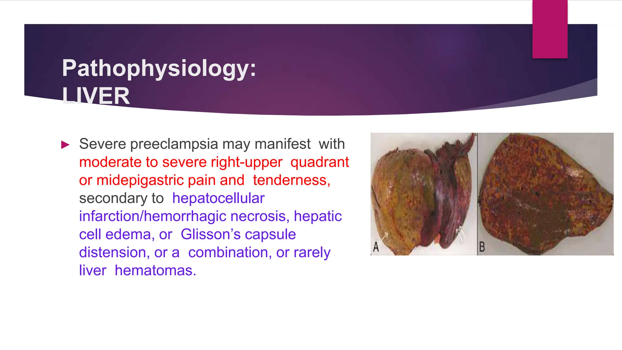hypertensive-disorders-of-pregnancy.pptx