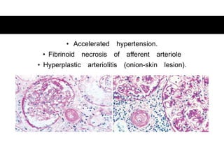 Basic science and forensic pathology aspects of Hypertensive ...
