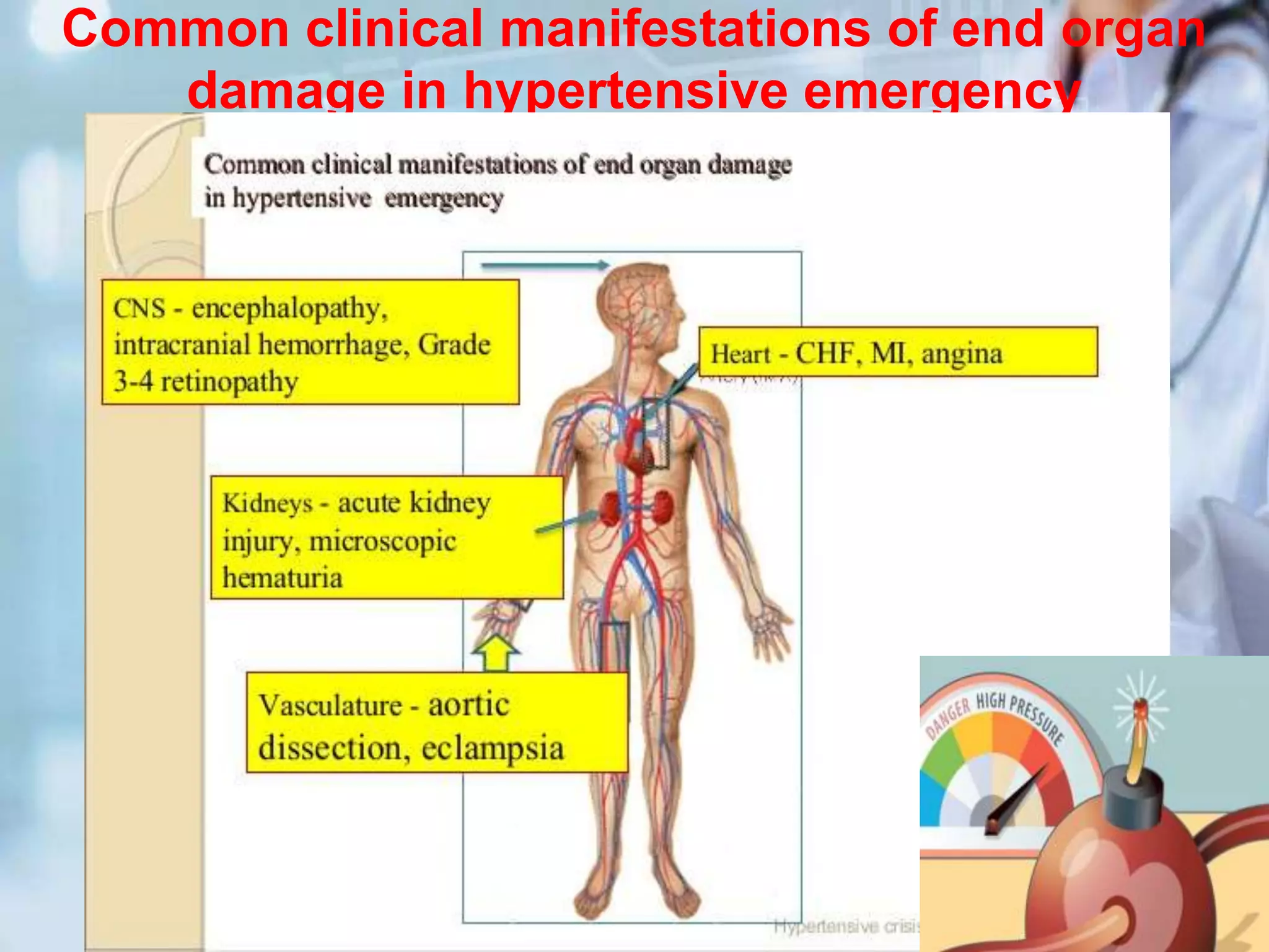 HYPERTENSIVE CRISIS | PPTX