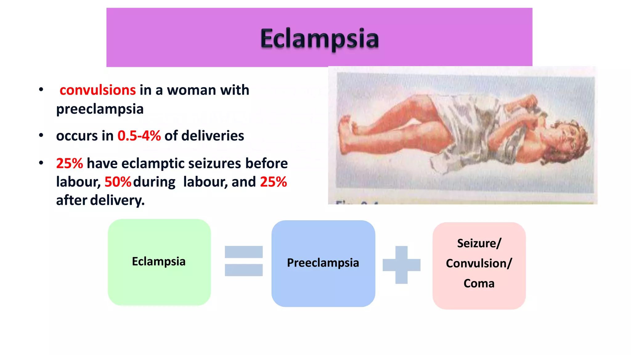 Hypertensive disorders during pregnancy pptx | PPTX