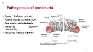 hypertensive disorders of pregnancy.pptx