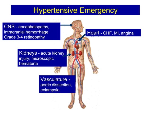 Hypertensive emergency.pptx