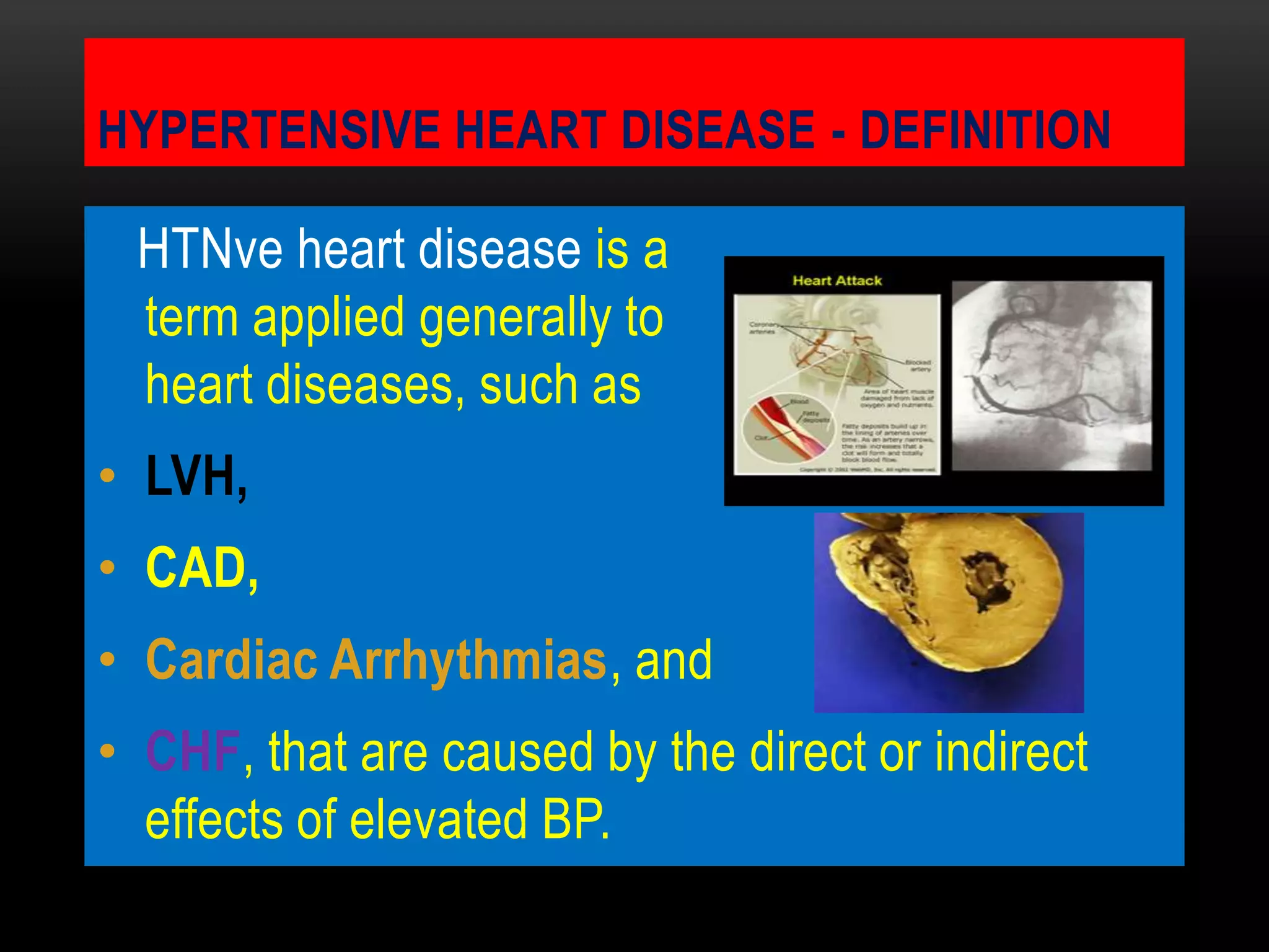 Hypertensive heart disease | PPTX