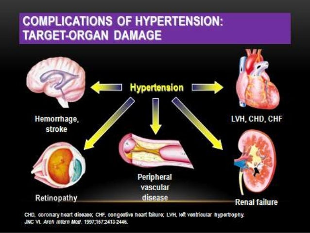 Hypertensive heart disease