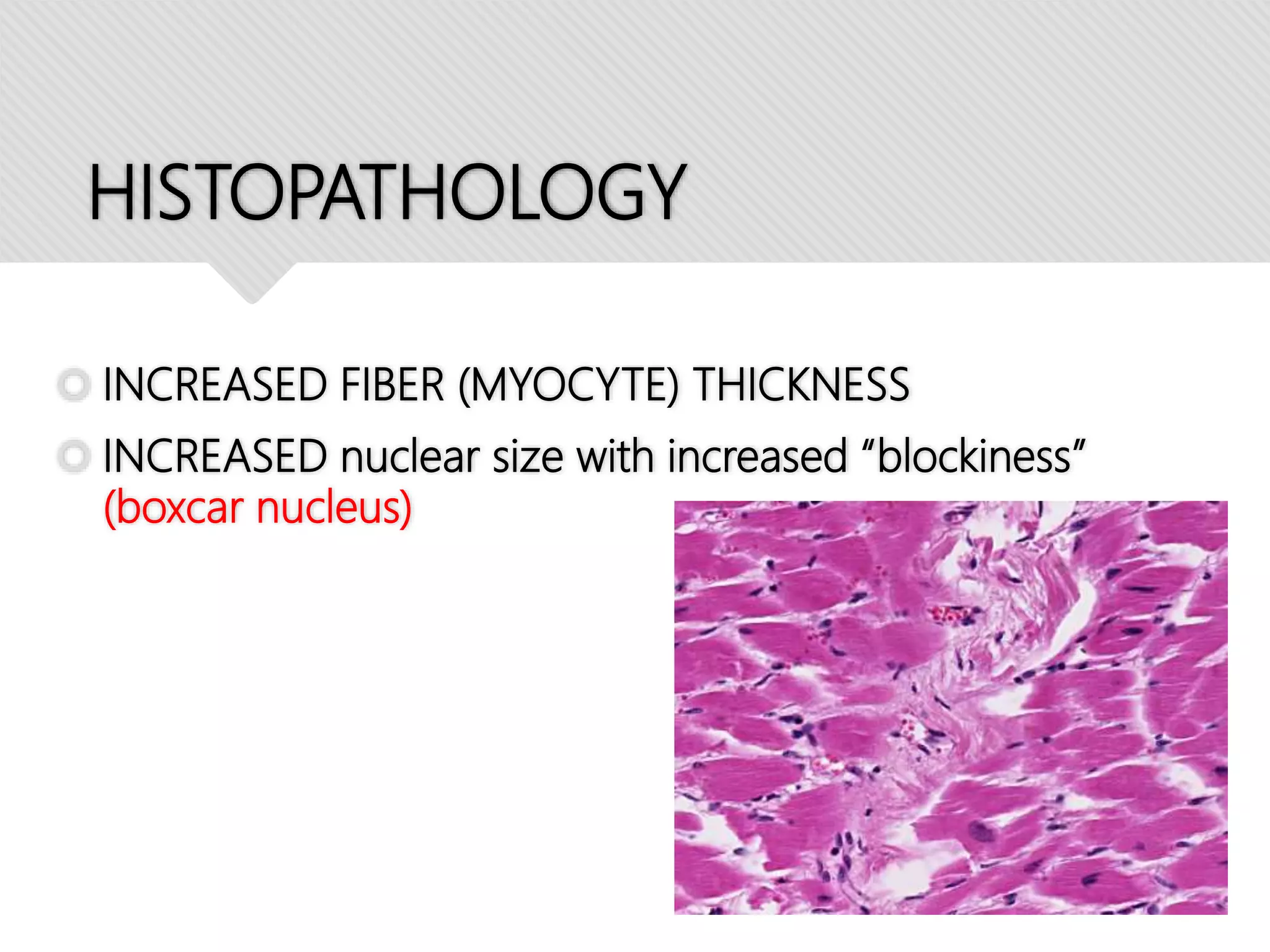 Hypertensive heart disease (hhd) | PPTX