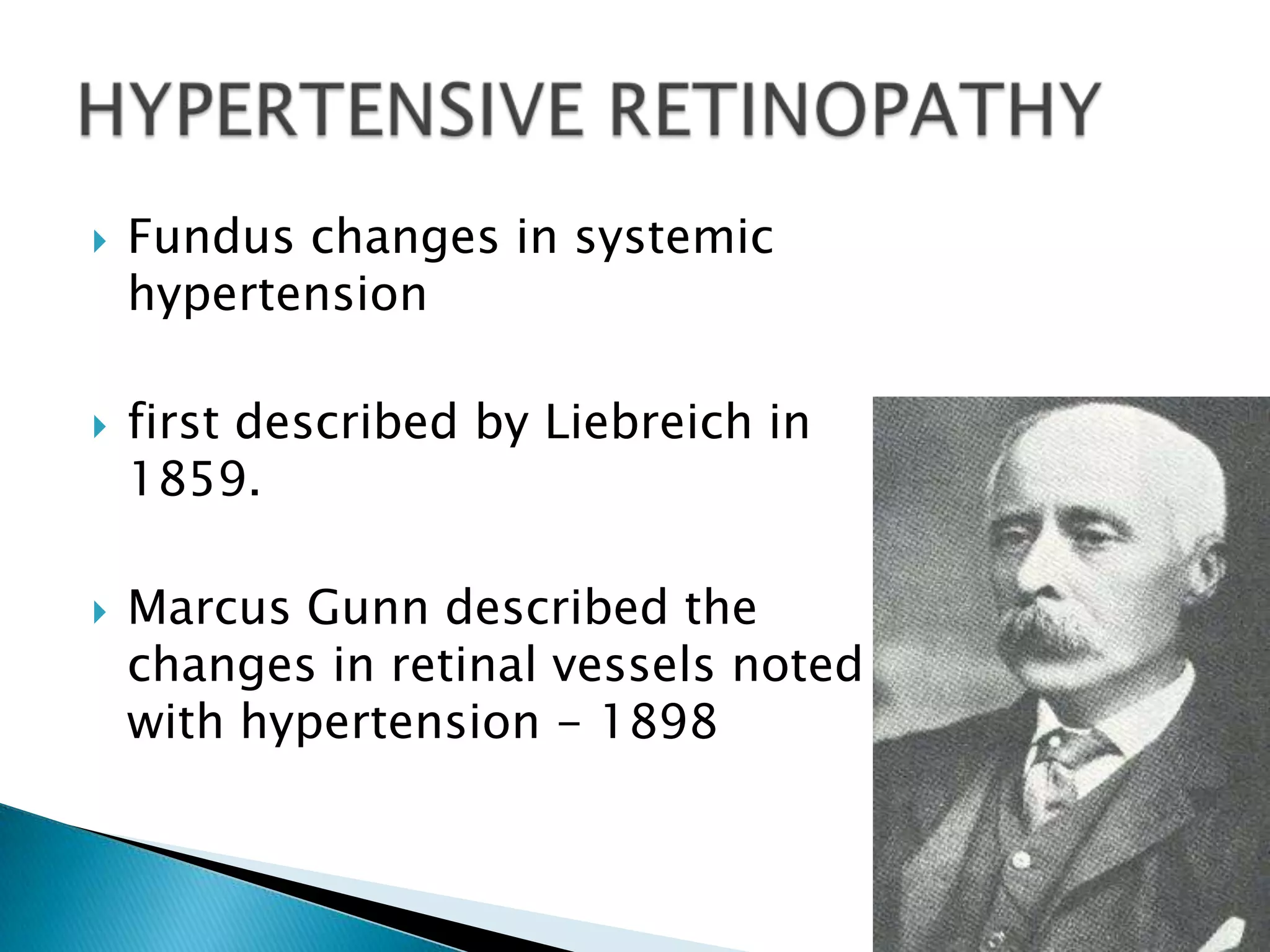 Hypertension and ocular changes | PPTX