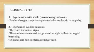 Hypertensive retinopathy | PPT
