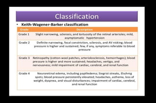 Hypertensive retinopathy,Dr M SAQUIB | PDF