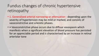 Hypertensive retinopathy.pptx
