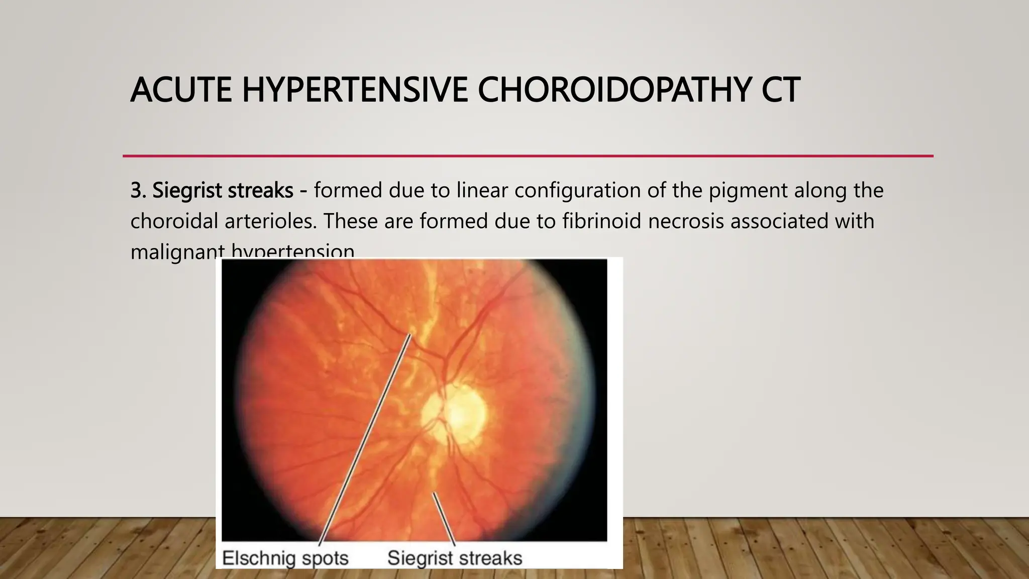 HYPERTENSIVE RETINOPATHY.2023 12111325246pptx | PPTX