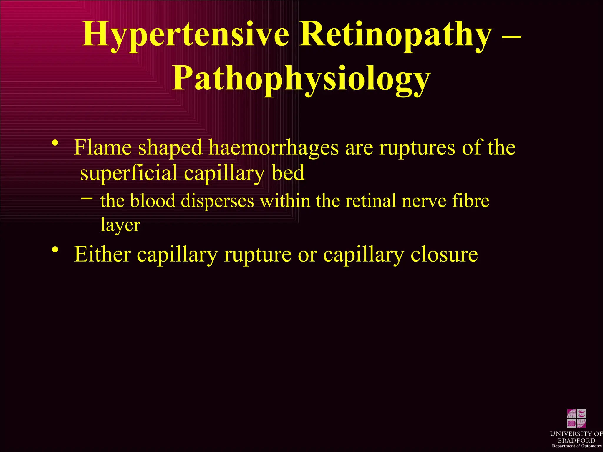 Hypertensive retinopathy.pptx for post graduates | PPTX