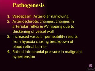 Hypertensive retinopathy.pptx for post graduates | PPTX
