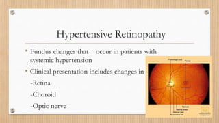 Morden opthalomology Hypertensive retinopathy.pptx