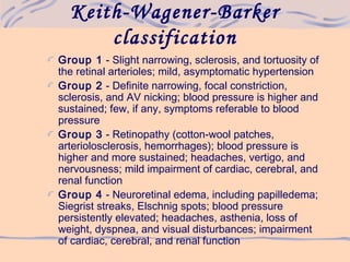 Hypertensive Retinopathy | PPT