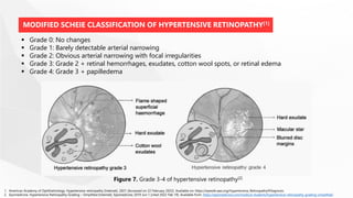 Hypertensive Retinopathy (2).pptx