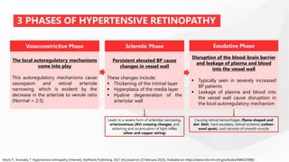 Hypertensive Retinopathy (2).pptx