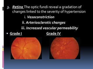 Hypertenson and IHD | PPTX