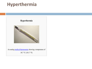 Hyperthermia | PPTX