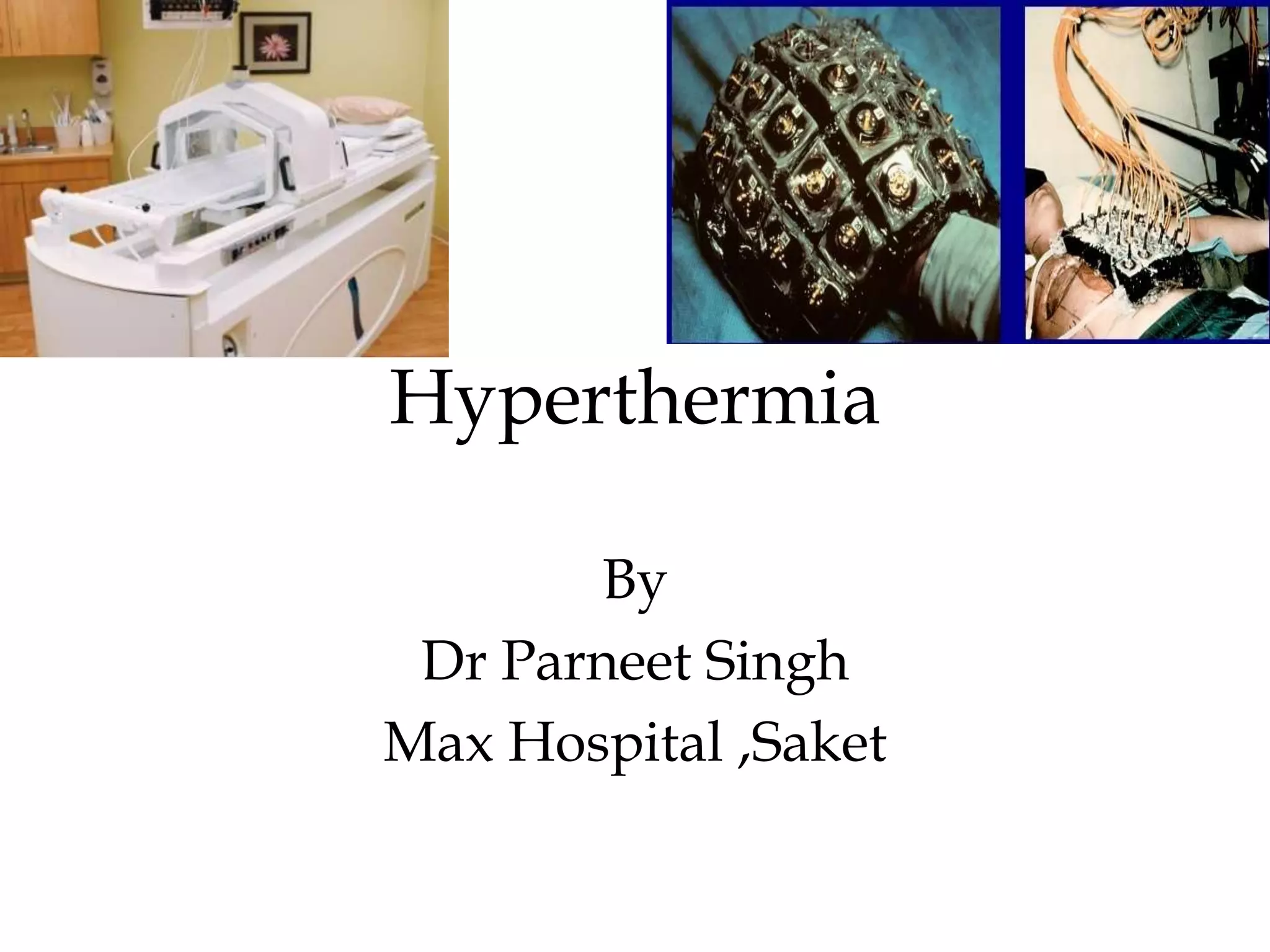 Hyperthermia | PPTX