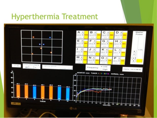 Hyperthermia Treatment