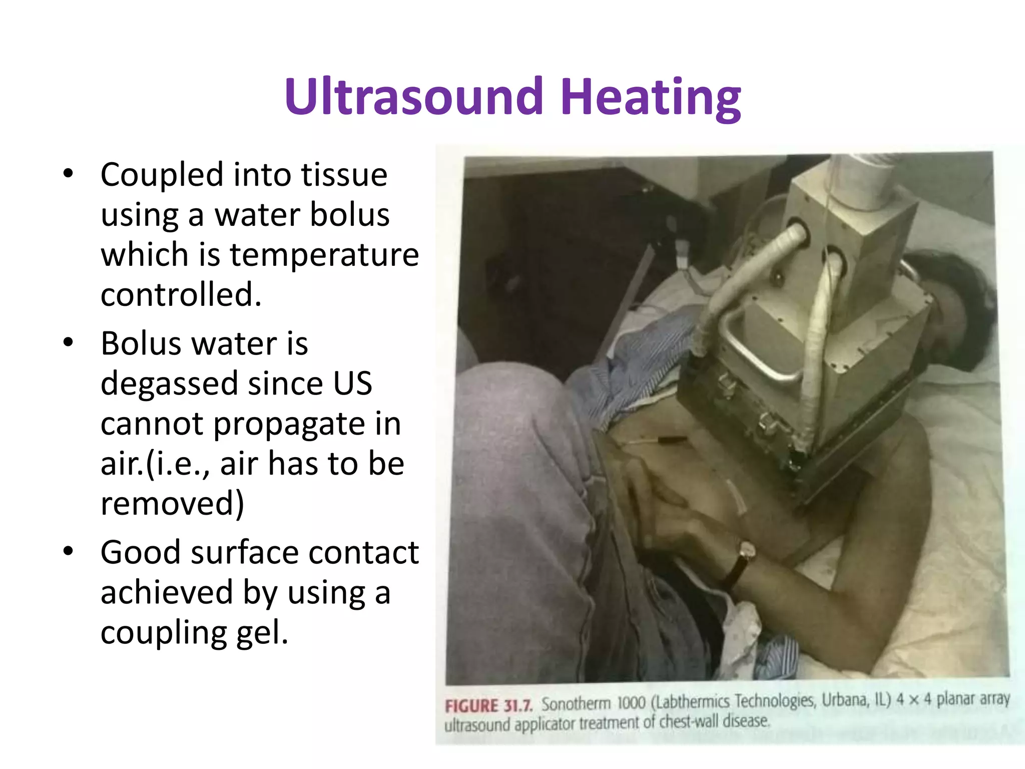 Hyperthermia in radiotherapy | PPTX