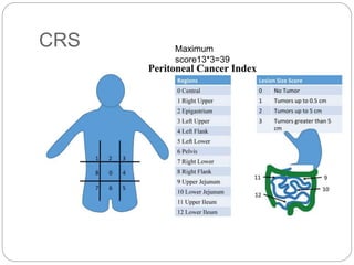 Hyperthermic intraperitoneal chemotherapy | PPTX