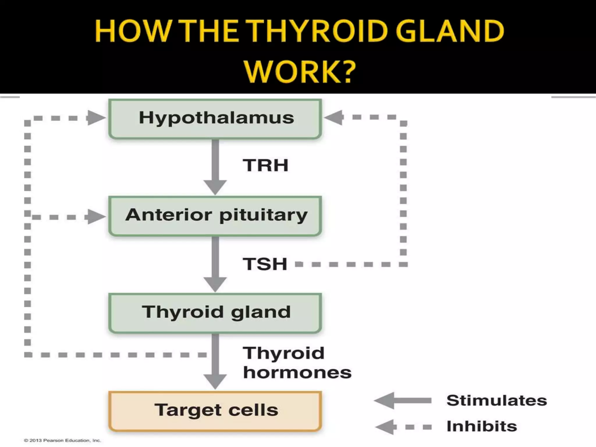 Hyperthyroidism | PPTX