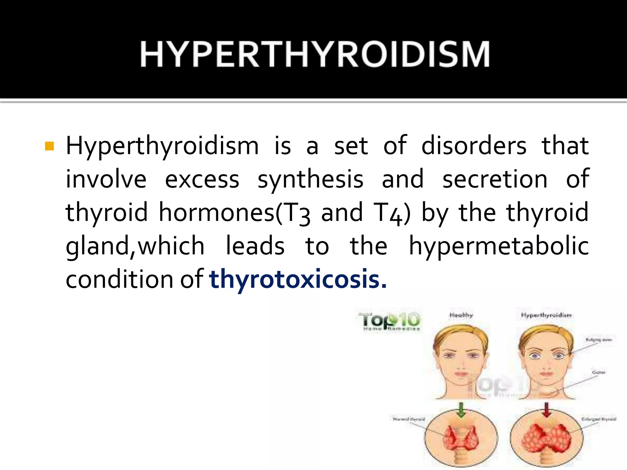 Hyperthyroidism | PPTX