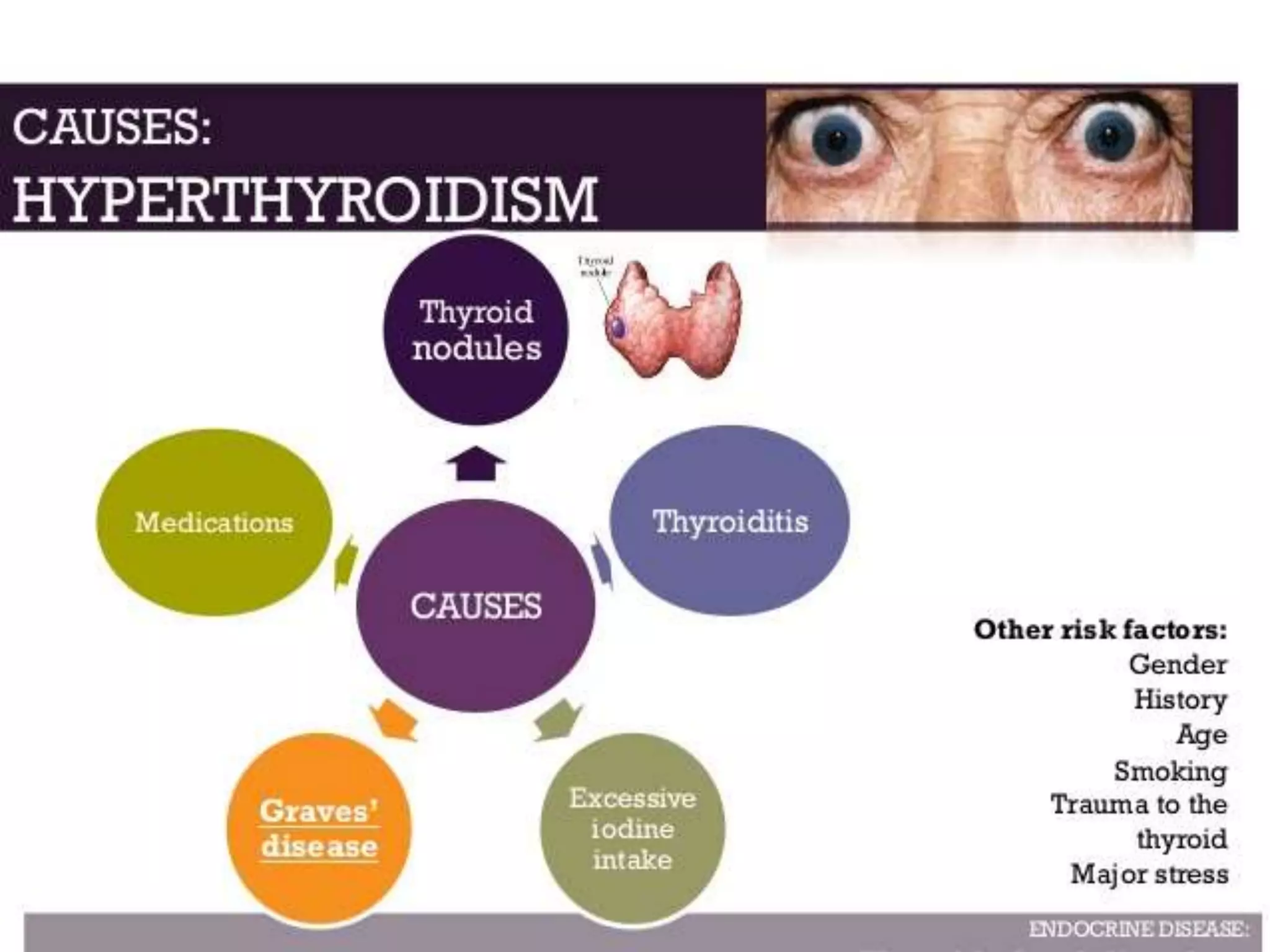 Hyperthyroidism | PPTX