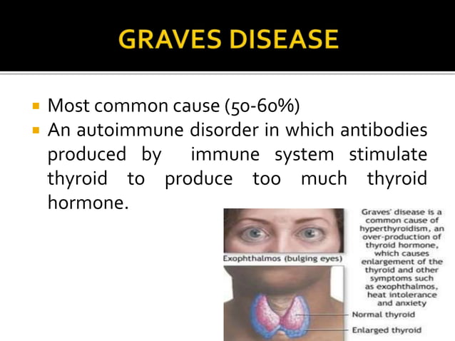Hyperthyroidism | PPTX | Thyroid Disorders | Endocrine and Metabolic ...