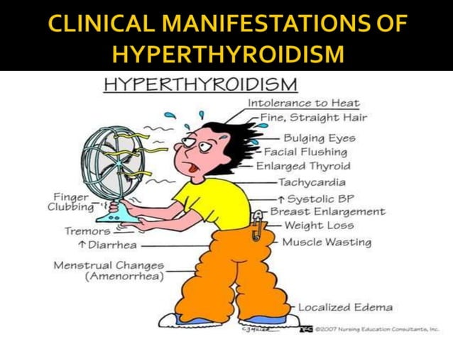 Hyperthyroidism | PPTX | Thyroid Disorders | Endocrine and Metabolic ...