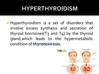 Hyperthyroidism | PPTX