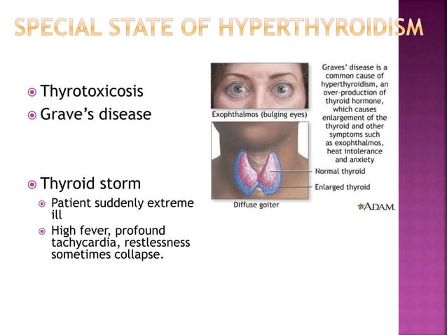 Hyperthyroidism | PPTX
