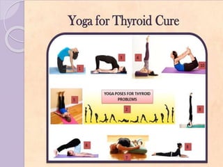 Hyperthyroidism / Thyrotoxicosis Pharmacotherapy | PPTX