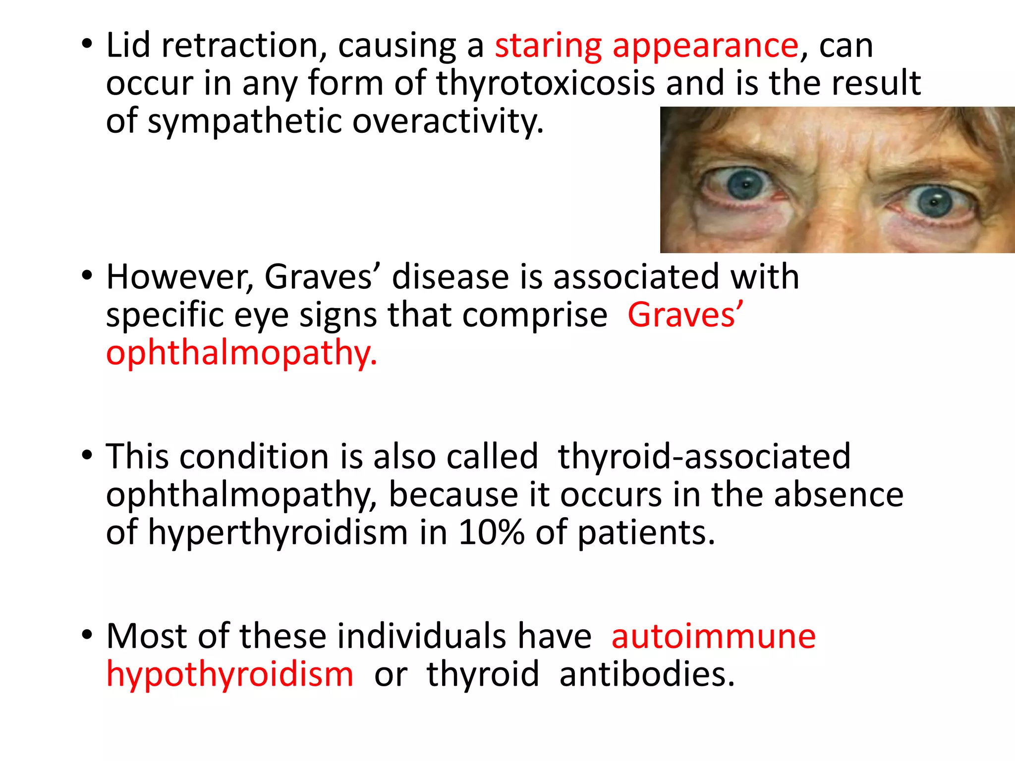 Hyperthyroidism-2022.pptx