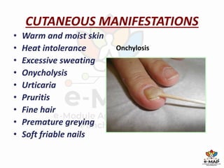 HYPERTHYROIDISM.pptx