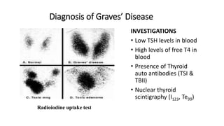 HYPERTHYROIDISM.pptx