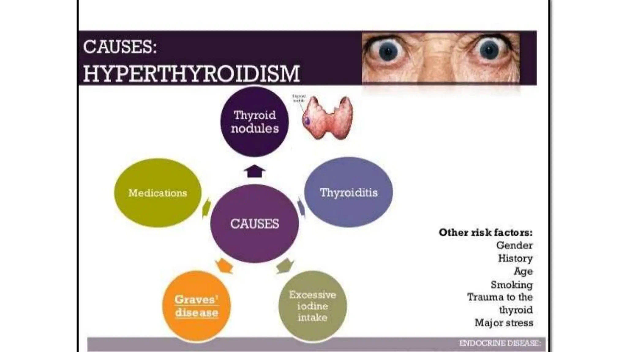 Hyperthyroidism thyroid disorders .pptx