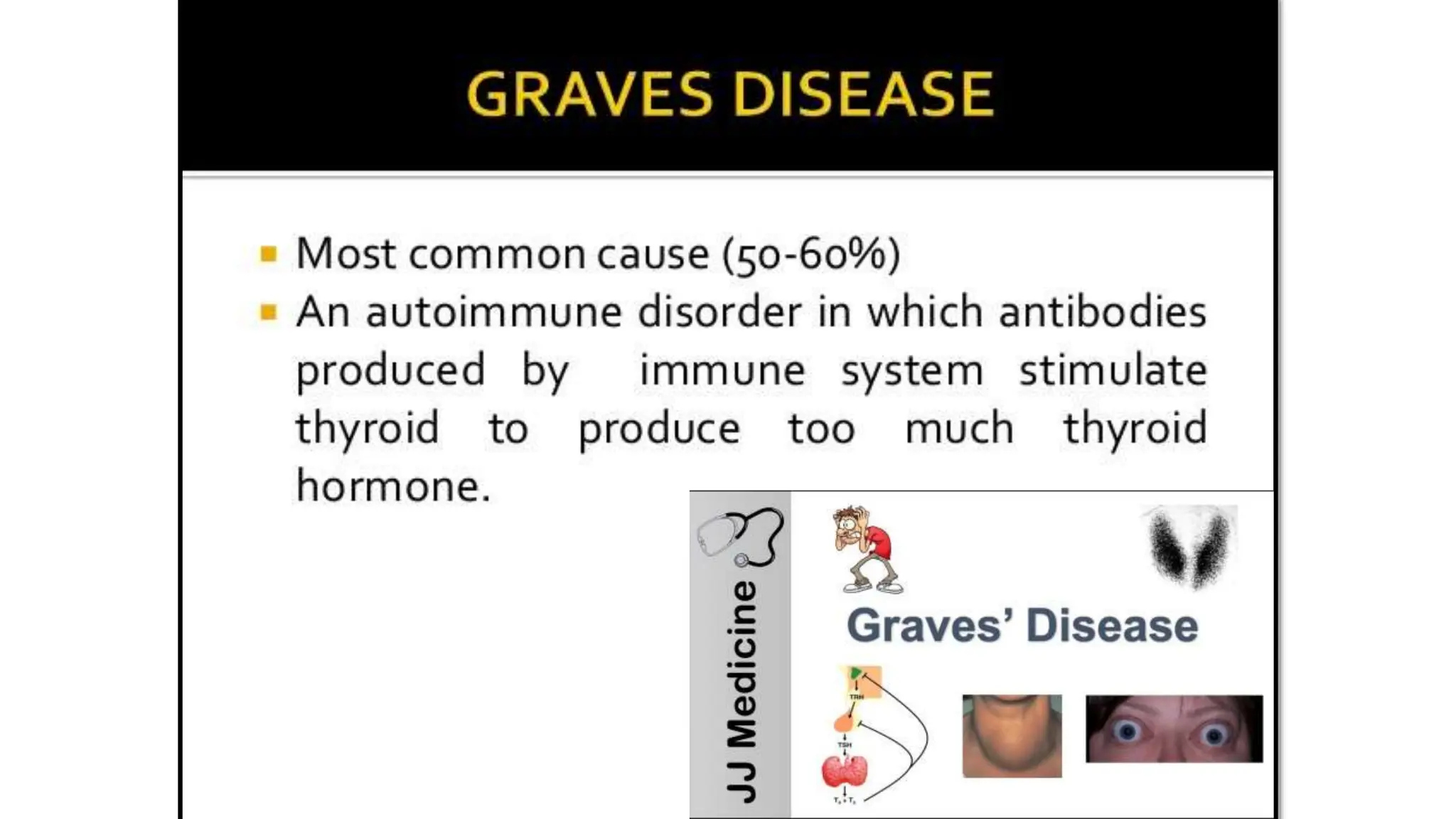 Hyperthyroidism thyroid disorders .pptx