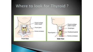 Hyperthyroidism thyroid disorders .pptx