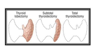Hyperthyroidism thyroid disorders .pptx | Free Download