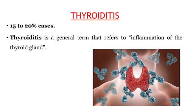 Hyperthyroidism thyroid disorders .pptx