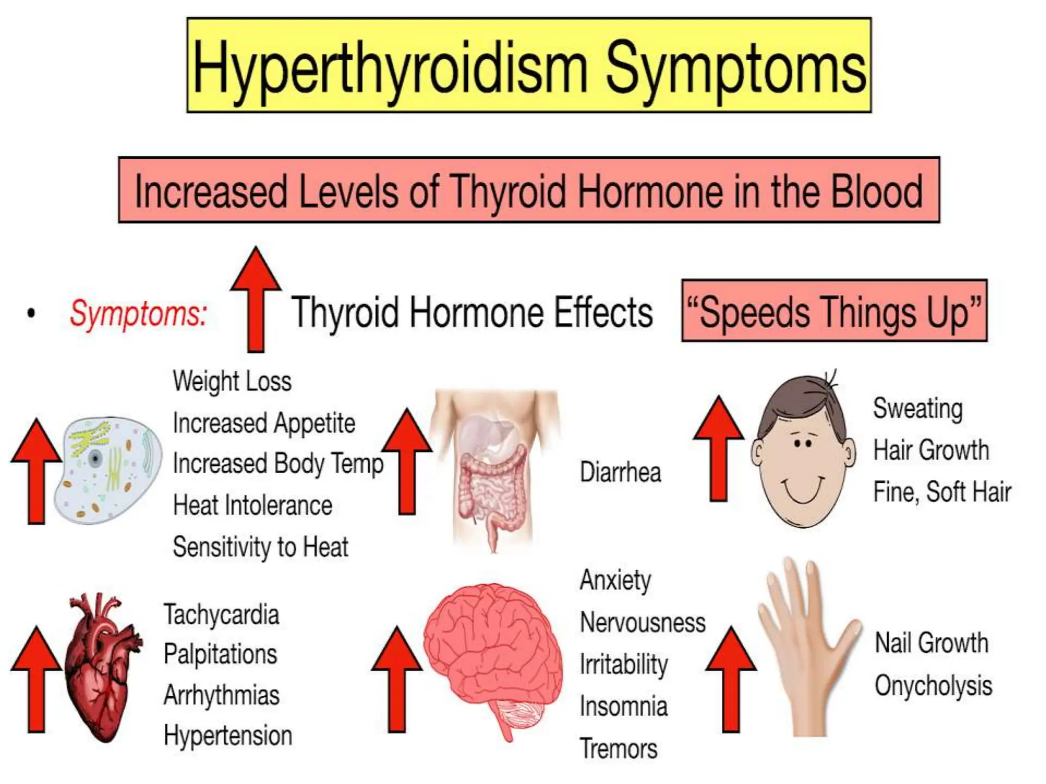 HYPERTHYROIDISM,clinical features and its management | PPT