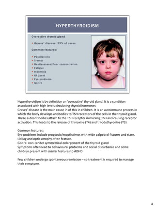 Hyperthyroidism In Children