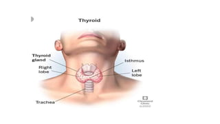 hyperthyroidism 1.pptx